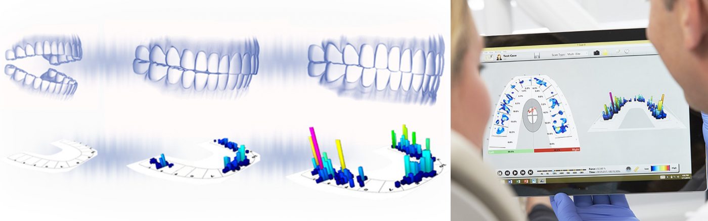 Tekscan – Pressure Mapping, Force Measurement & Tactile Sensors